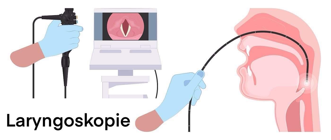 Laryngitida – u dospělých, u dětí, příznaky, léčba, nakažlivost ...